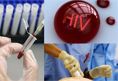Hai lần xét nghiệm âm tính liên tiếp sau phơi nhiễm HIV đã đủ an toàn ...