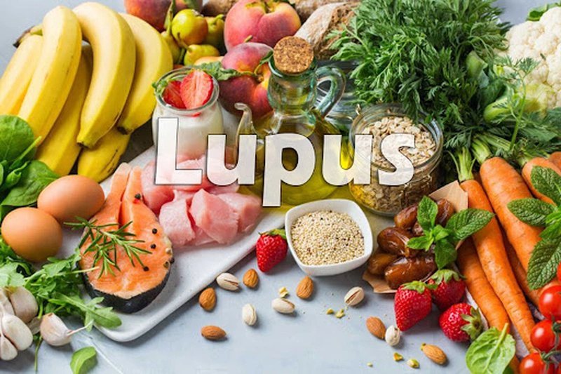 Chế độ ăn hạn chế tổn thương thận do Lupus | AI Hay - Hỏi ngay đáp hay