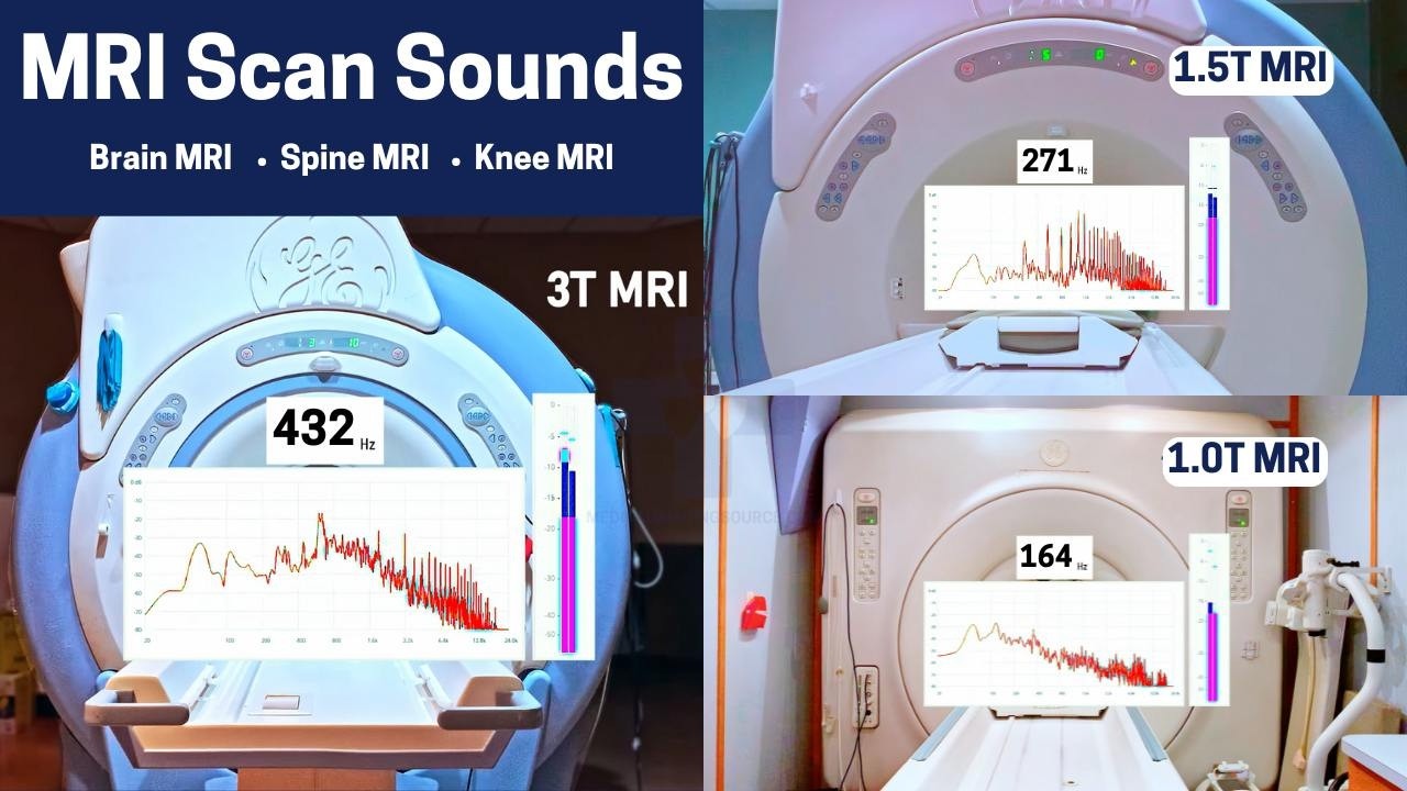 Máy MRI 3.0 Tesla có gây ra tiếng ồn lớn không? | AI Hay - Hỏi ngay đáp hay