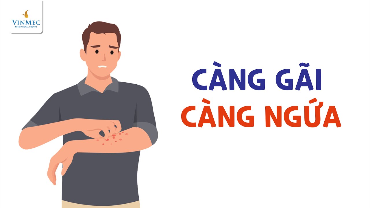 Nóng quá phát Ban ngứa chân tay làm cách gì khỏi | AI Hay - Hỏi ngay ...