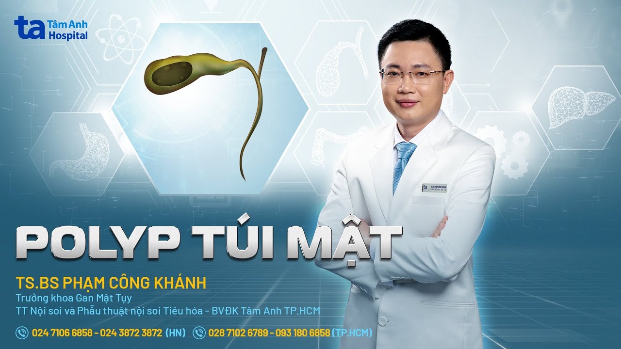 Polyp túi mật là gì và chúng có nguy hiểm không? | AI Hay - Hỏi ngay ...